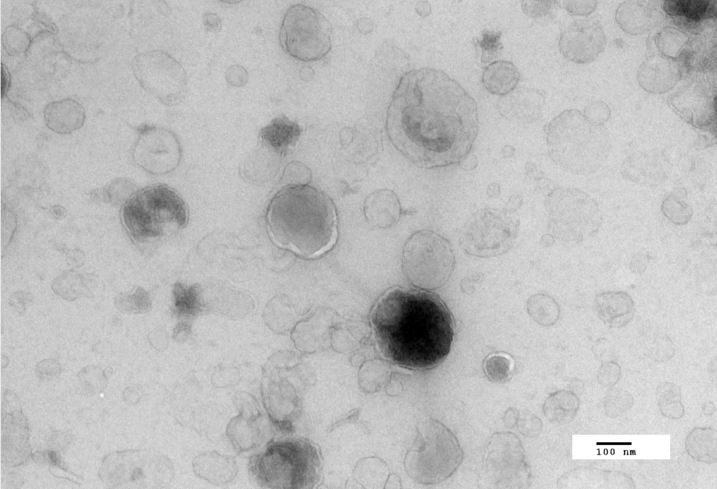New urine test for prostate cancer - Norwich Research Park Biorepository